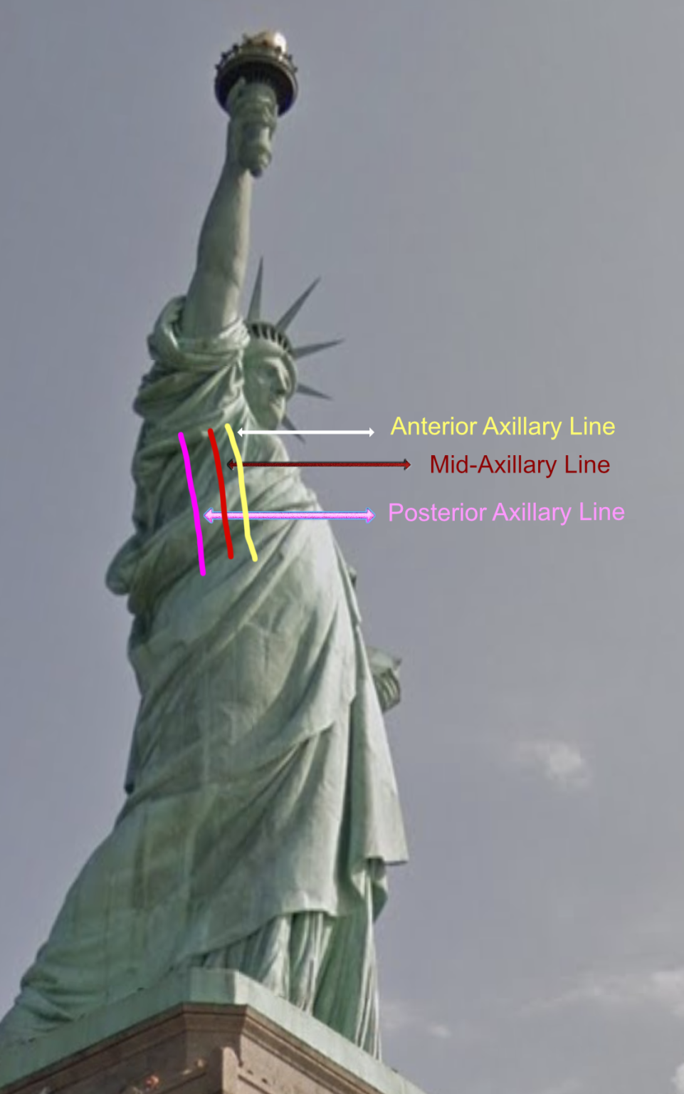 Axillary line - Sinclair Internal Arts